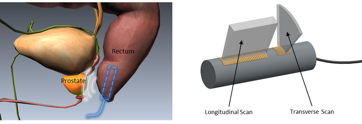 Novel Ultrasound Transducers Arrays For Biomedical Imaging Dr Xiaoning Jiang Research Group